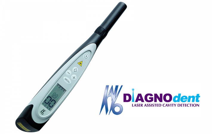 DIAGNOdent - Artistic Dental at the biltmore